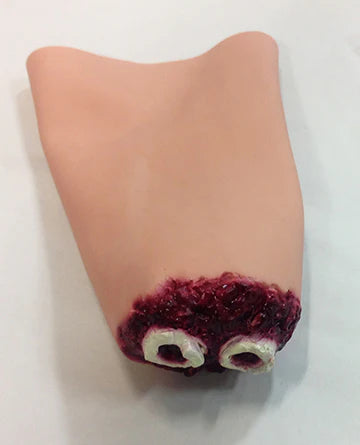 Hand Amputation – Anchor Simulation