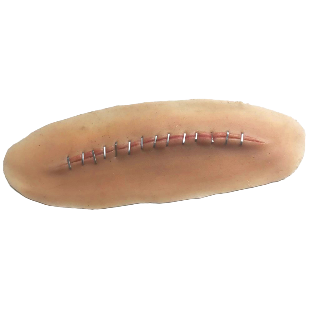 MedicFX Stick-on C-section Wound with Staples – Anchor Simulation