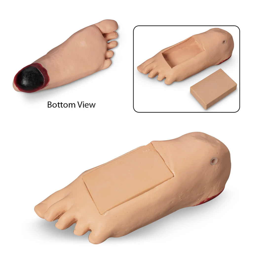 GERi and KERi Optional Edema Foot – Anchor Simulation