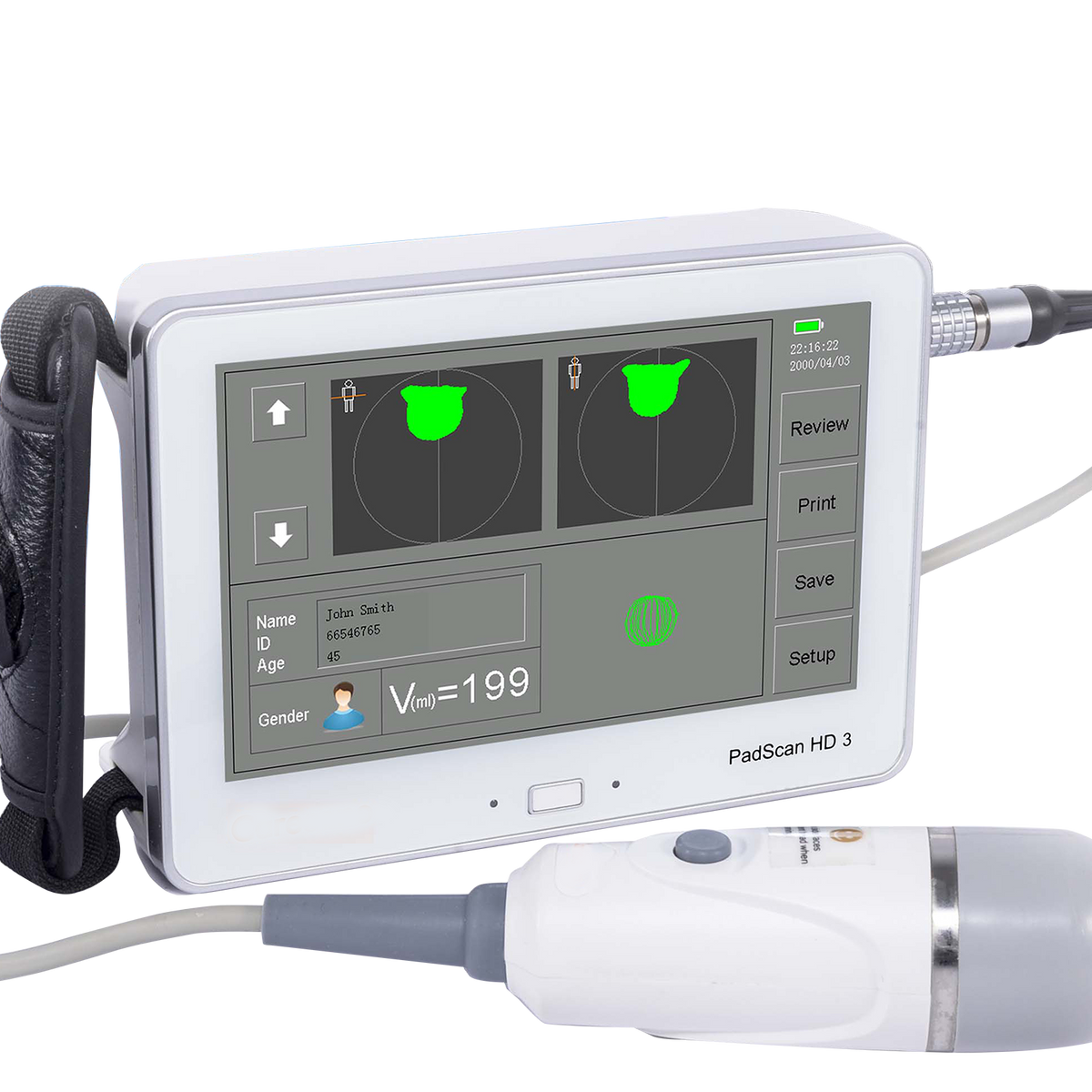 Caresono HD3 Bladder Scanner – Anchor Simulation